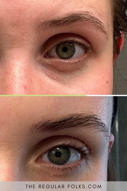 The Ordinary Lash Serum Review (Honest and Unsponsored) - The Regular Folks