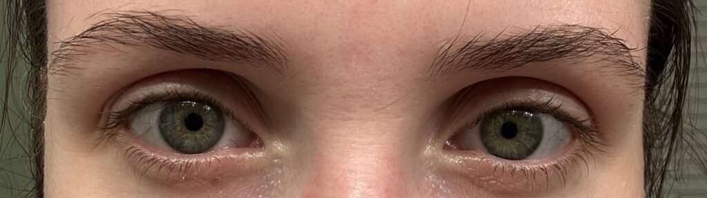 Terez & Honor Eyelash Serum Review (Honest and Unsponsored) - The ...