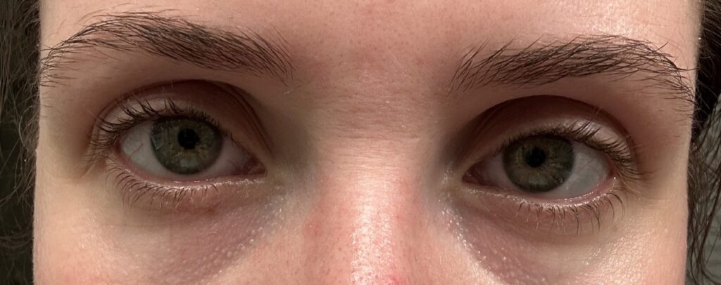 Terez & Honor Eyelash Serum Review (Honest and Unsponsored) - The ...