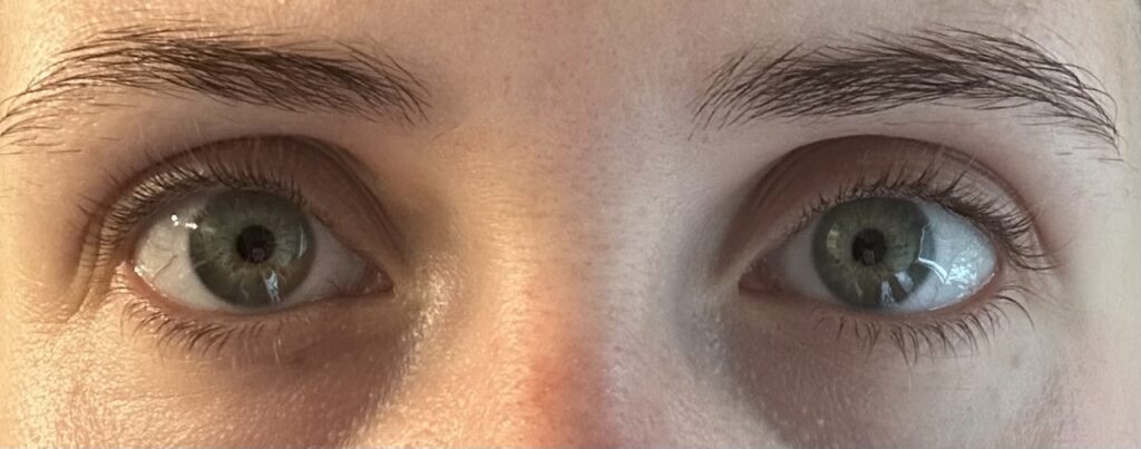 Terez & Honor Eyelash Serum Review (Honest and Unsponsored) - The ...